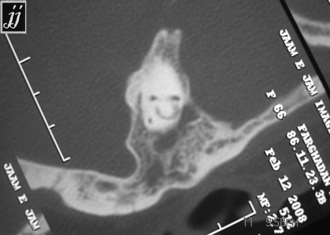 Human body zoo – old man – Radiopaedia